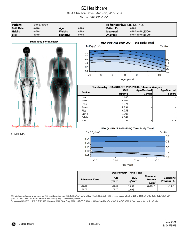 GE Healthcare Body Composition Report Sample GE Healthcare Body Composition Report Sample